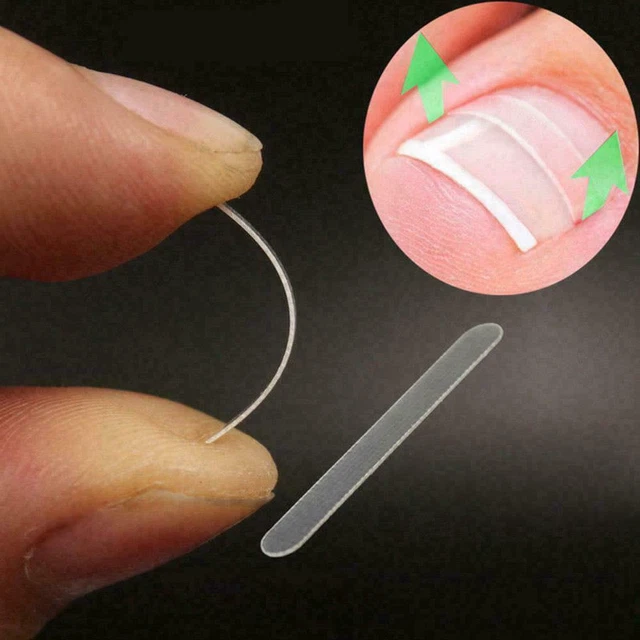 10 INGROWN TOENAIL Straightening Clip Curved Brace nail To Toe $2.11 ...