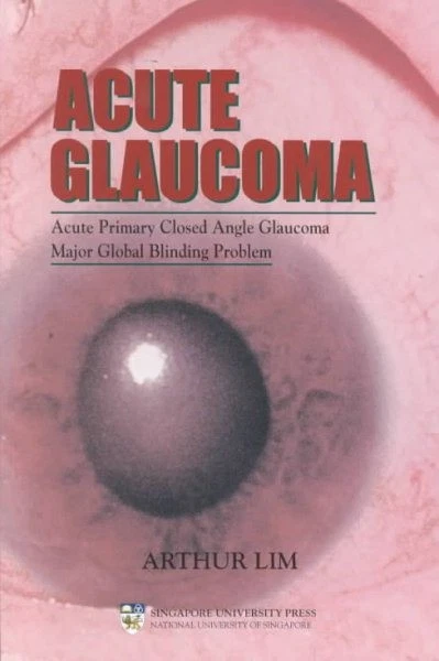 ACUTE GLAUCOMA : Acute Primary Closed Angle Glaucoma Major Global Blinding Pr... £15.00 ...