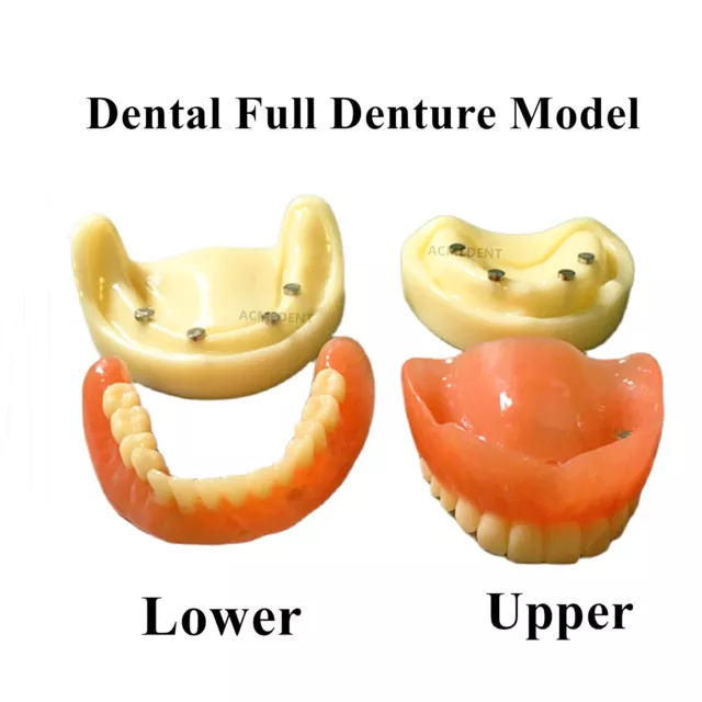 DENTAL FULL DENTURE Model Overdenture Magnetic Attachment Mandibular ... DENTAL FULL DENTURE Model Overdenture Magnetic Attachment Mandibular ...