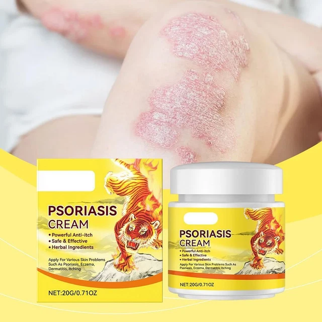 PSORIASIS CREAM DERMATITIS Pruritus Eczema Ointment Anti Itching ...