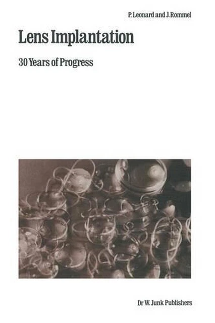 LENS IMPLANTATION: 30 Years of Progress by P. Leonard (English ...
