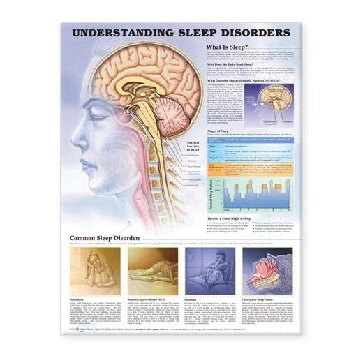 UNDERSTANDING SLEEP DISORDERS Anatomical Wall Chart £14.95 - PicClick UK