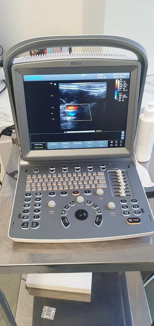 NEW ULTRASOUND SCANNER - Chison ECO 6 with 7.5MHz linear transducer ...
