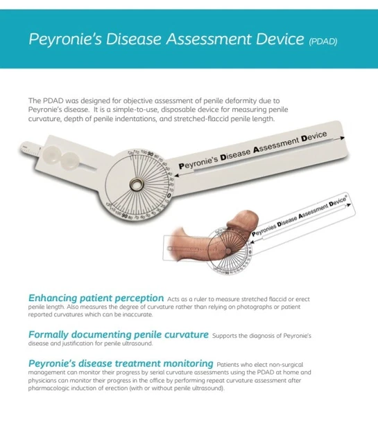 PEYRONIE’S DISEASE ASSESSMENT Device (PDAD) to measure improvement ...