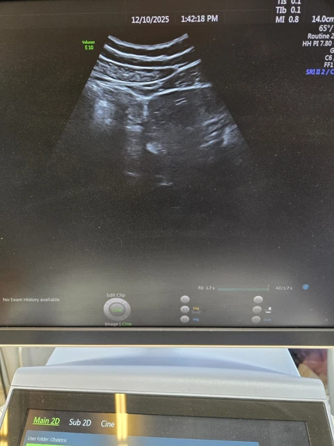GE EM6C 4D Volumetric OB/GYN Ultrasound Probe Tested Working $7,060.58 ...