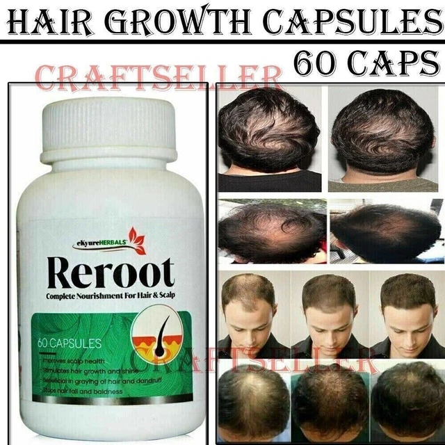 FAST HAIR GROWTH Booster Supplement Grow Faster Longer Thicker Fuller ...