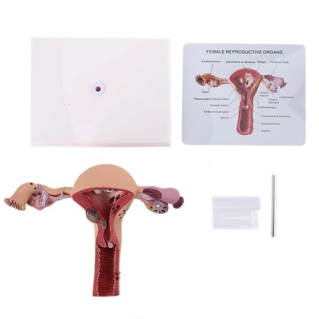 HUMAN FEMALE UTERUS Ovary Disease Dissection Pathology Model Biology ...