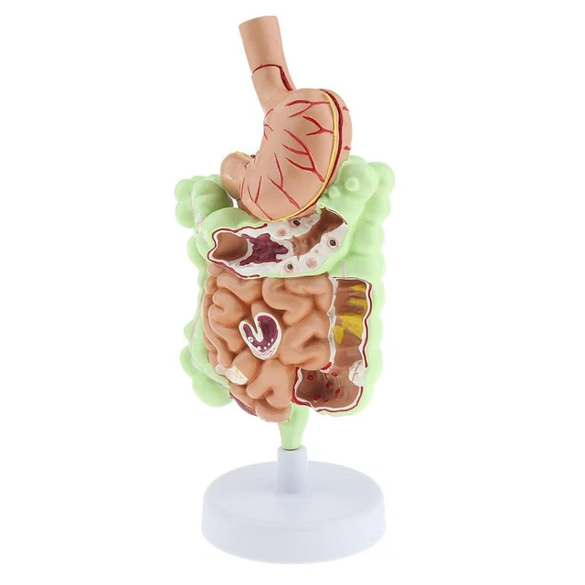 HUMAN ANATOMY DIGESTIVE System Model Human Stomach Gastrointestinal ...