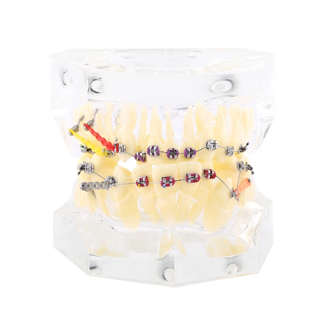DIY DENTAL ORTHODONTIC Treatment Malocclusion Study Teeth Model With ...