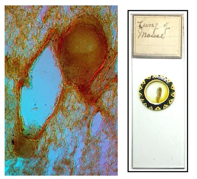 ANTIQUE MICROSCOPE SLIDE ~ Lung of Mouse ~ Decorative Ringing by J.W ...