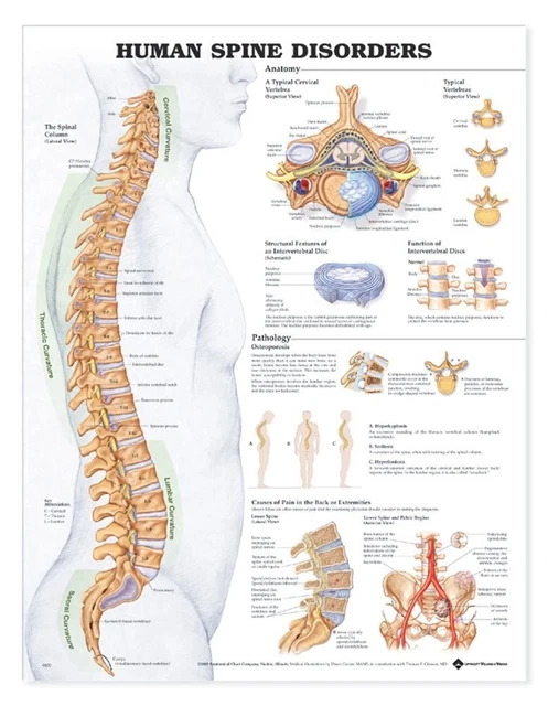 HUMAN SPINE DISORDERS Anatomical Chart by Anatomical Chart Co (Fold-out ...