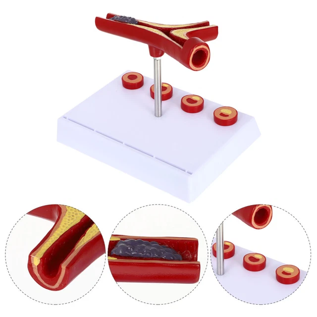 CARDIOVASCULAR MODEL BLOOD Vessel Anatomy Human Circulatory System £23. ...