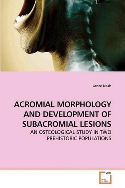 ACROMIAL MORPHOLOGY AND Development of Subacromial Lesions: AN ...