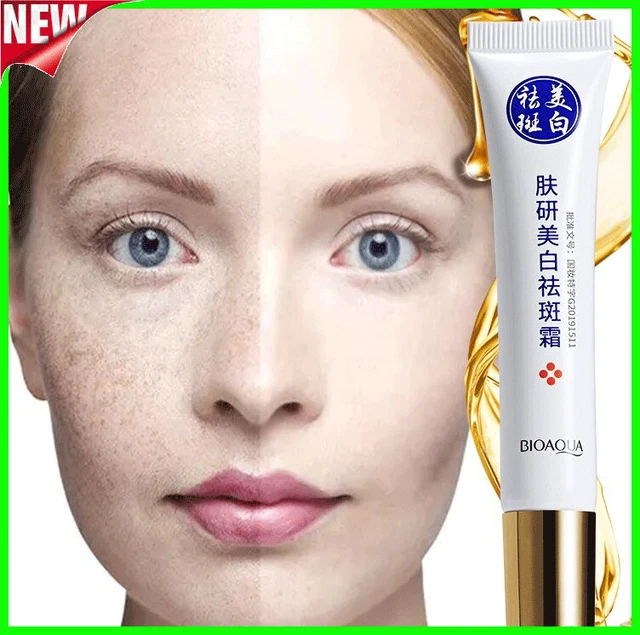 TAGOUT MOLE REMOVAL Cream Whiten Freckle Cream Melasma Dark Spots ...