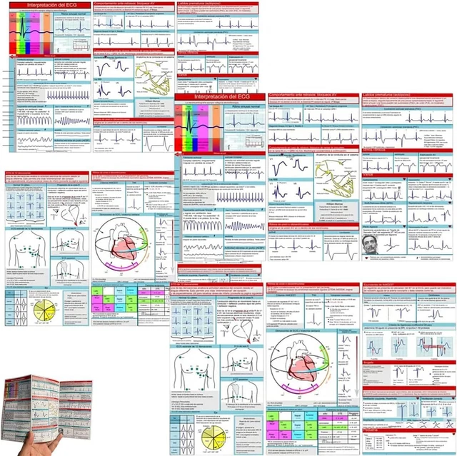 EKG POCKET GUIDE, EKG/EKG Rhythmus Pocket Card doppelseitige ...