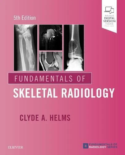 FUNDAMENTALS DE ESQUELETO Radiology Por Helms Md ,Clyde Un Nuevo Libro ...