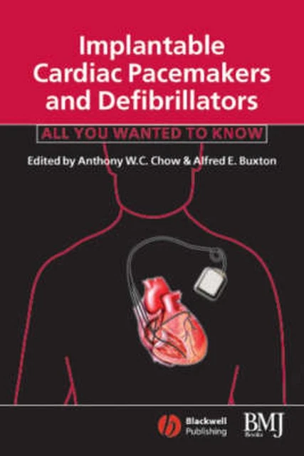 IMPLANTABLE CARDIAC PACEMAKERS and Defibrillators: All You Wanted to ...