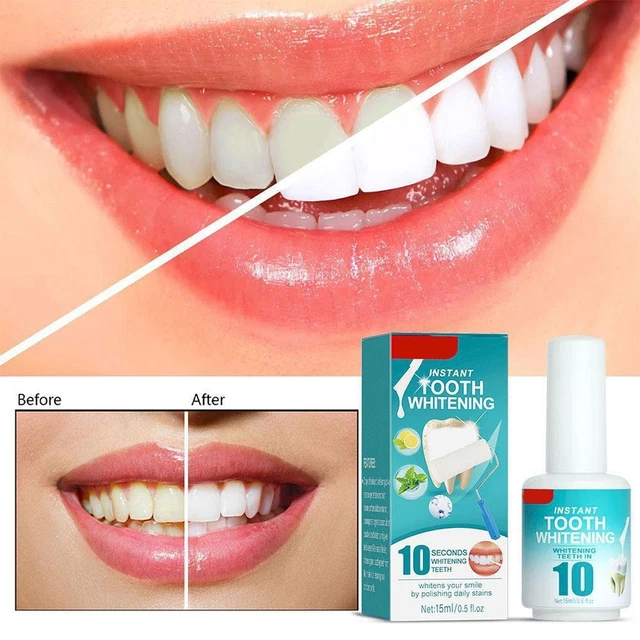 TOOTH PAINT, INSTANT Tooth Whitening Paint Instant Whitening Paint-For ...