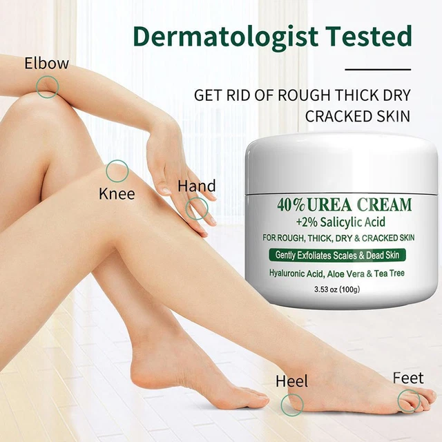 UREA CREAM - Say Goodbye to Calluses and Dry Skin - 42% Urea Foot U3A3 ...