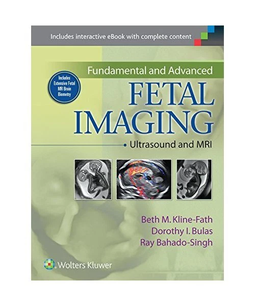 FUNDAMENTAL AND ADVANCED Fetal Imaging: Ultrasound and MRI, Beth M ...