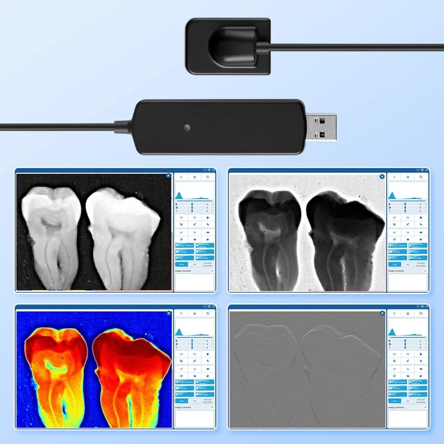 DENTAL SENSOR DIGITAL de rayos x Intraoral Digital System HD Image Size ...
