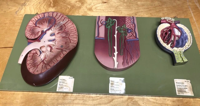 SOMSO LS9 KIDNEY, Nephron and Glomerulus Model Set Anatomical Model ...