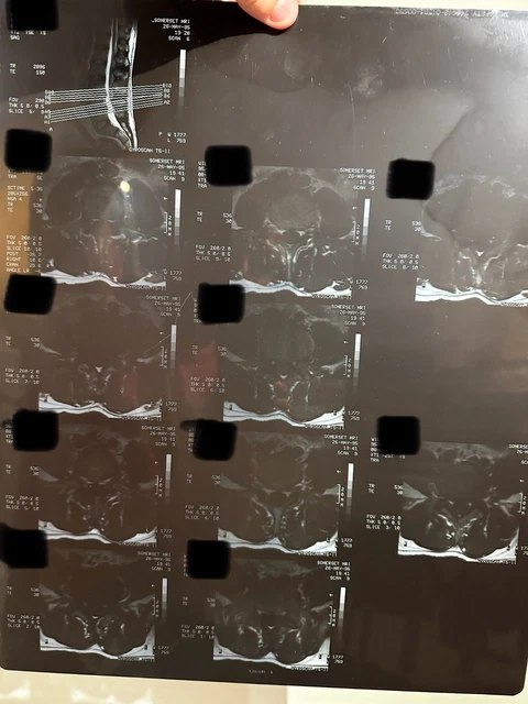 GENUINE VINTAGE HOSPITAL Human X-Ray MRI Scan Tomography Original ...