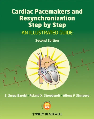 CARDIAC PACEMAKERS AND Resynchronization Step by Step: An... - Barold ...