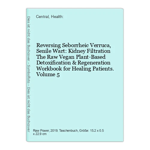 REVERSING SEBORRHEIC VERRUCA, Senile Wart: Kidney Filtration The Raw ...