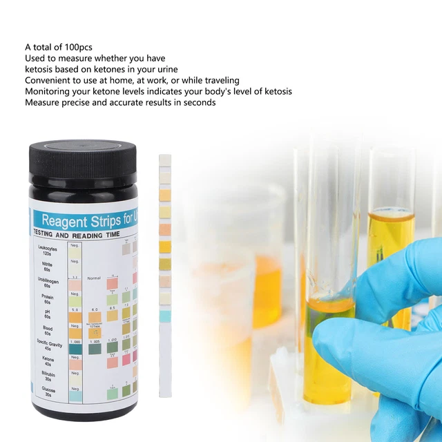 100X URINE TEST Strip 10 Parameters Urinalysis Dip-Stick Testing Kit ...