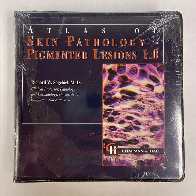 ATLAS OF SKIN Pathology Pigmented Lesions v1.0 Multimedia CD-ROM New ...