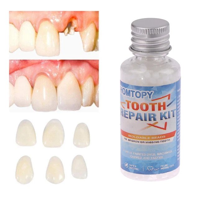TEMPORARY TOOTH REPAIR Kit Teeth Gaps False Teeth Solid Glue Denture ...