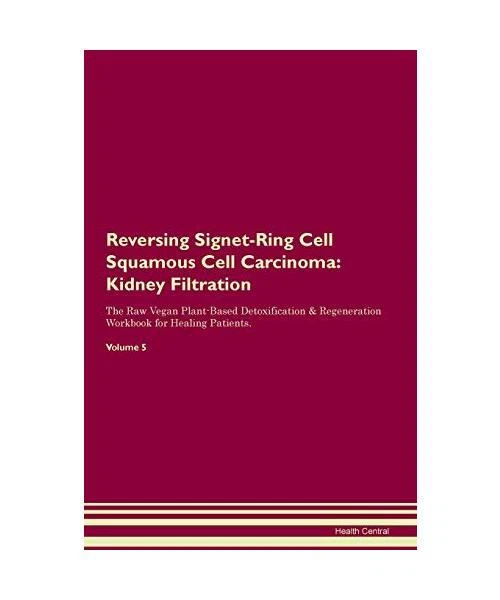 REVERSING SIGNET-RING CELL Squamous Cell Carcinoma: Kidney Filtration ...