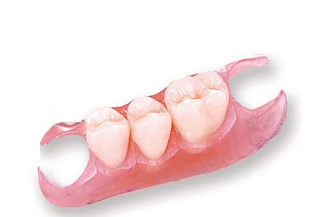 CUSTOM FIT NESBIT/FLIPPER - ThermoPlas Flexible Partial Denture £211.64 ...