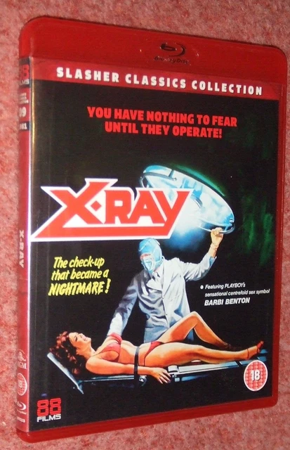 X Ray Aka Hospital Massacre Slasher Classic Uk Blu Ray Barbi Benton Eur 2499 Picclick It