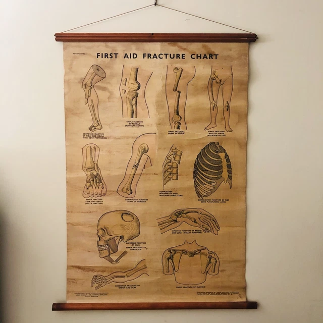 VINTAGE ANATOMY MEDICAL First Aid Wall Chart £90.00 - PicClick UK