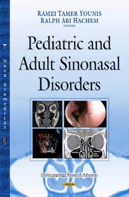 PARANASAL SINUSES: ANATOMY, Development & Biological Function by Ramzi ... PARANASAL SINUSES: ANATOMY, Development & Biological Function by Ramzi ...