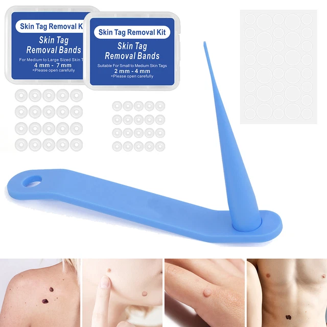 SKIN TAG REMOVAL Tool Kit, Skin Tag Removers with Repair Patches ...