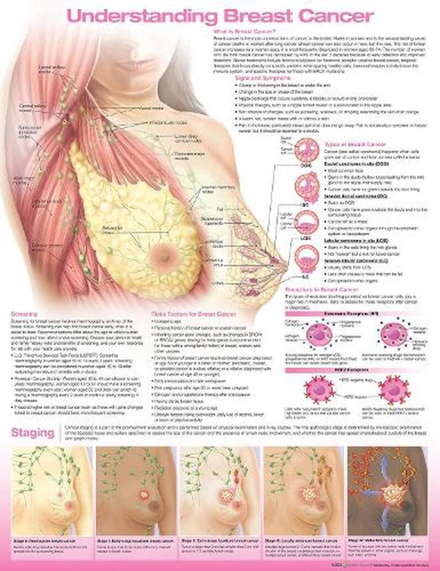 Understanding Breast Cancer Anatomical Chart By Anatomical Chart
