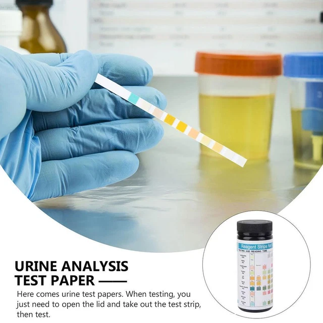 100 STRIPS URS-10T Urinalysis Reagent Strips 10 Parameters Urine Test ...