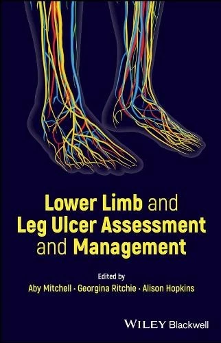 ALISON HOPKINS LOWER Limb and Leg Ulcer Assessment and M (Paperback ...