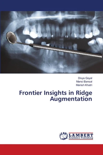 FRONTIER INSIGHTS IN Ridge Augmentation by Divya Goyal Paperback Book ...