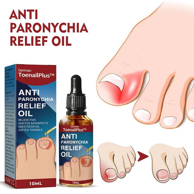 1* TOENAILPLUS NAILPROP Anti Paronychia Relief Oil 2023 Z5R7 EUR 2,18 - PicClick FR