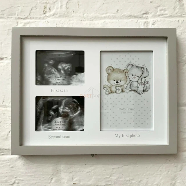 BABY SCAN PHOTO Frame Hanging Ultrasound First Picture Baby Shower Gift ...