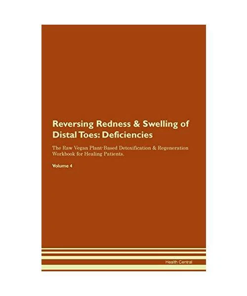REVERSING REDNESS & Swelling of Distal Toes: Deficiencies The Raw Vegan ...