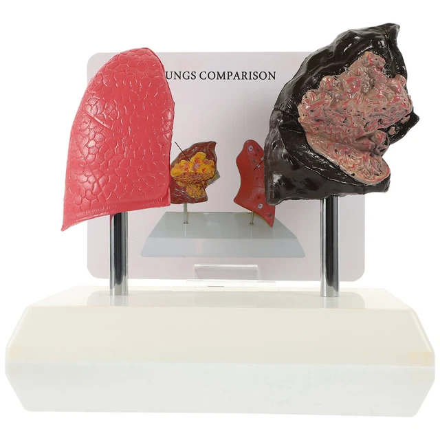 MEDICAL SCHOOL EDUCATIONAL Model Lung Medical Models £42.75 - PicClick UK