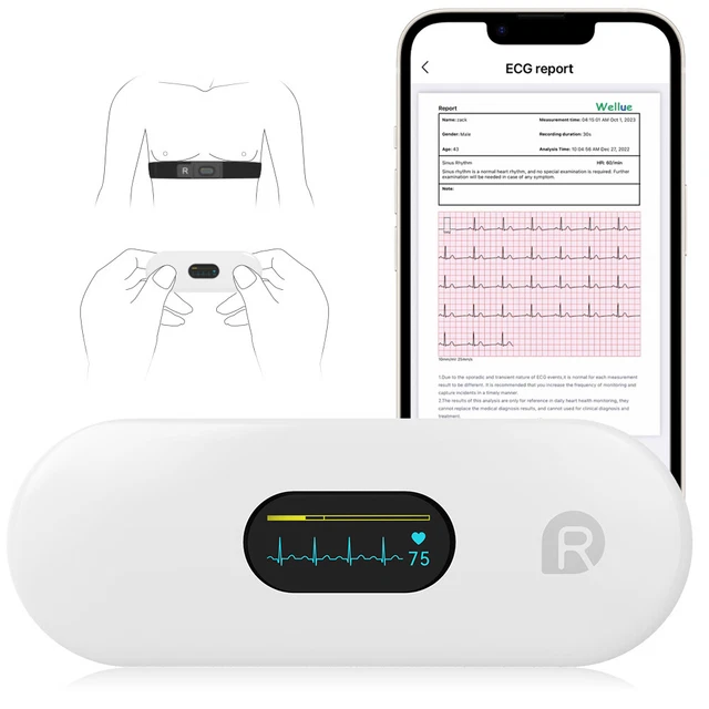EKG ECG MONITOR 30s to 15mins ECG Recording Detects Afib AI-ECG ...