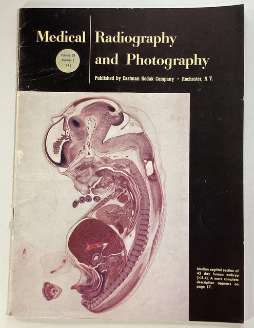RADIOLOGY MAGAZINE 1952 Radiography Photography Embryo Fetal Develop Pregnancy £33.64 - PicClick UK