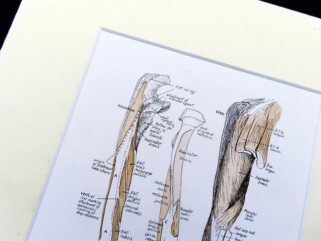 HUMAN ANATOMY CHART Ulna Bone Muscle Structure Ligaments Old Antique ...