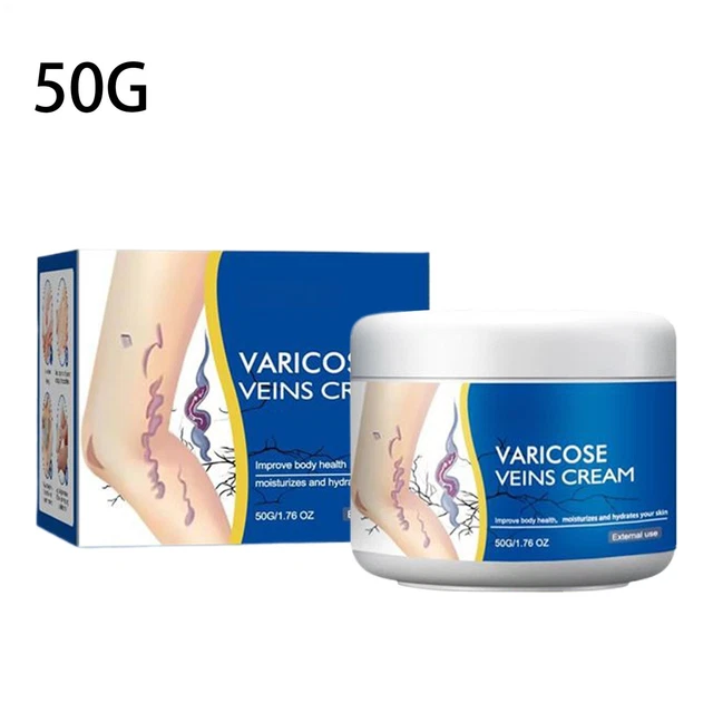 VARICOSE VEINS TREATMENT Cream Vasculitis Phlebitis Spider Relief Pain ...